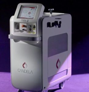 Used Candela GentleMax Pro Plus For Sale - Sunray Laser Equipment